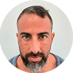 Injerto Capilar Barcelona - Dr. Joel Chara
